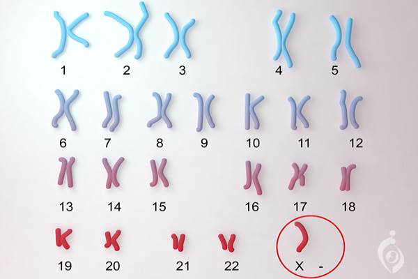 Karyotyping and diagnosis of diseases — fxhash